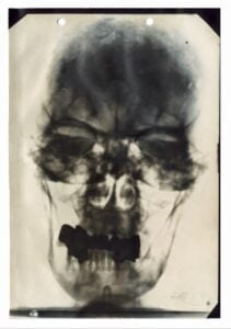 On Hitler's Teeth - or, the Death of a Dictator. | Roger Moorhouse